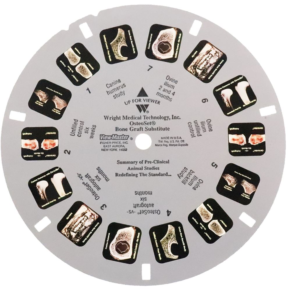 Wright Medical Technology, Inc. OsteoSet - View-Master Commercial Reel ...